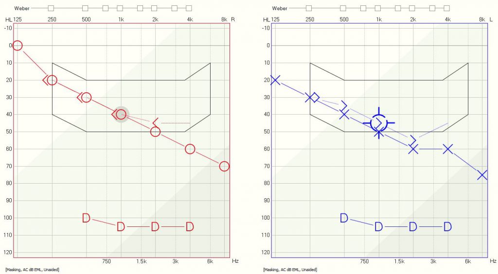 Testen met fluittonen - Second Opinion Hoortoestellen